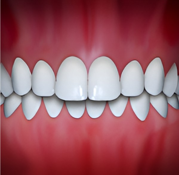 Common Orthodontic Problems | Canepa Orthodontics